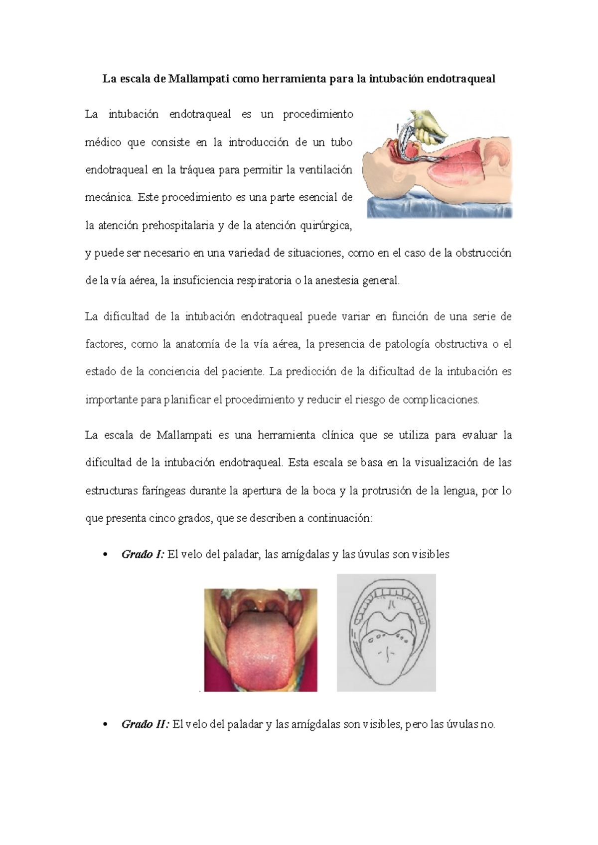 Uso de la Escala de Mallampati para Intubación Endotraqueal - Studocu