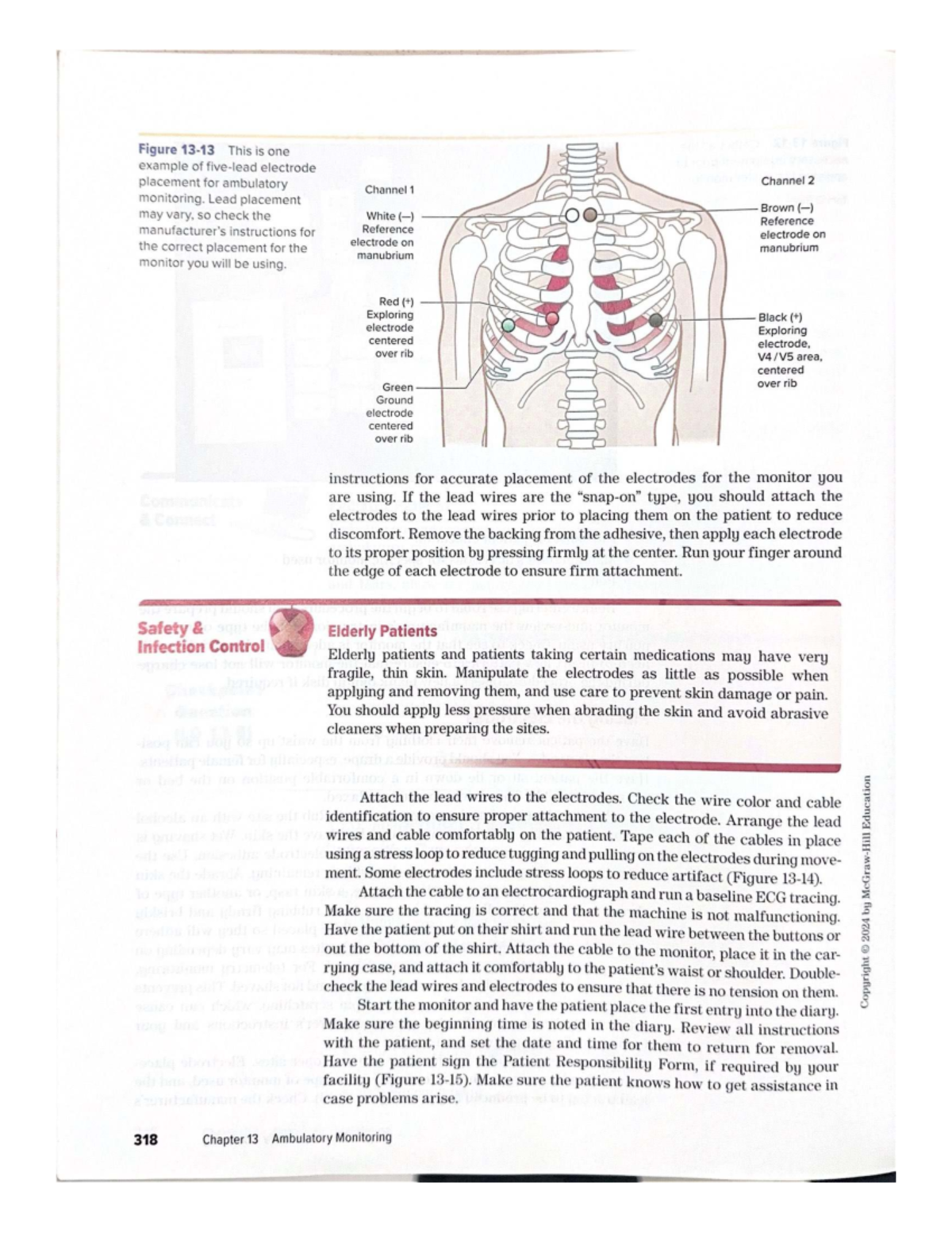24-25 ECG Ch. 13: Guidelines for Ambulatory Monitoring and Electrode ...