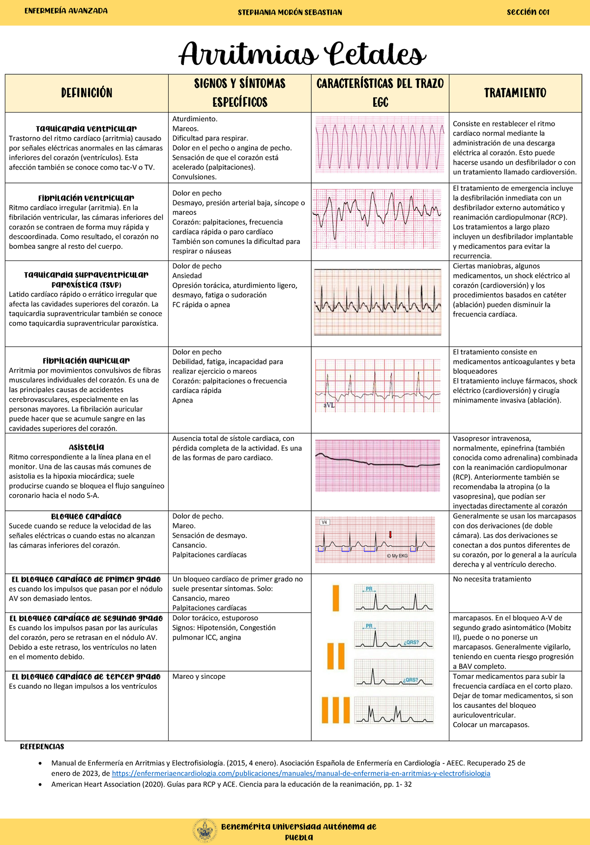 Guía de Arritmias Cardiacas - ENFERMERÍA AVANZADA 001 - Studocu