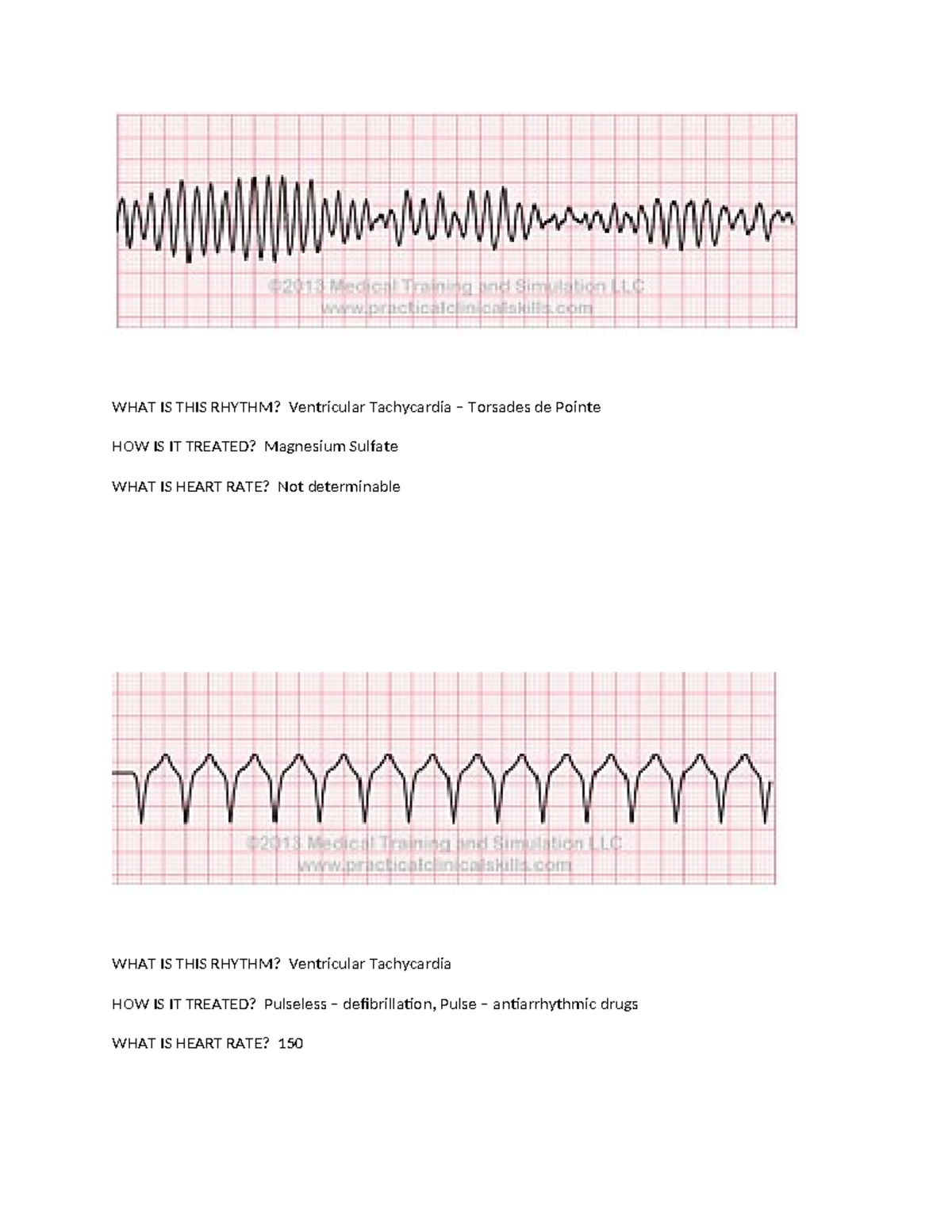 EKG Interpretation Practice - Answer Key for Cardiac Rhythms - Studocu