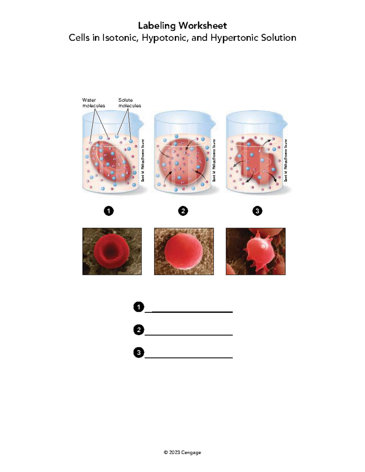 Chapter 4 Labeling Worksheets: Isotonic, Hypotonic, Hypertonic ...