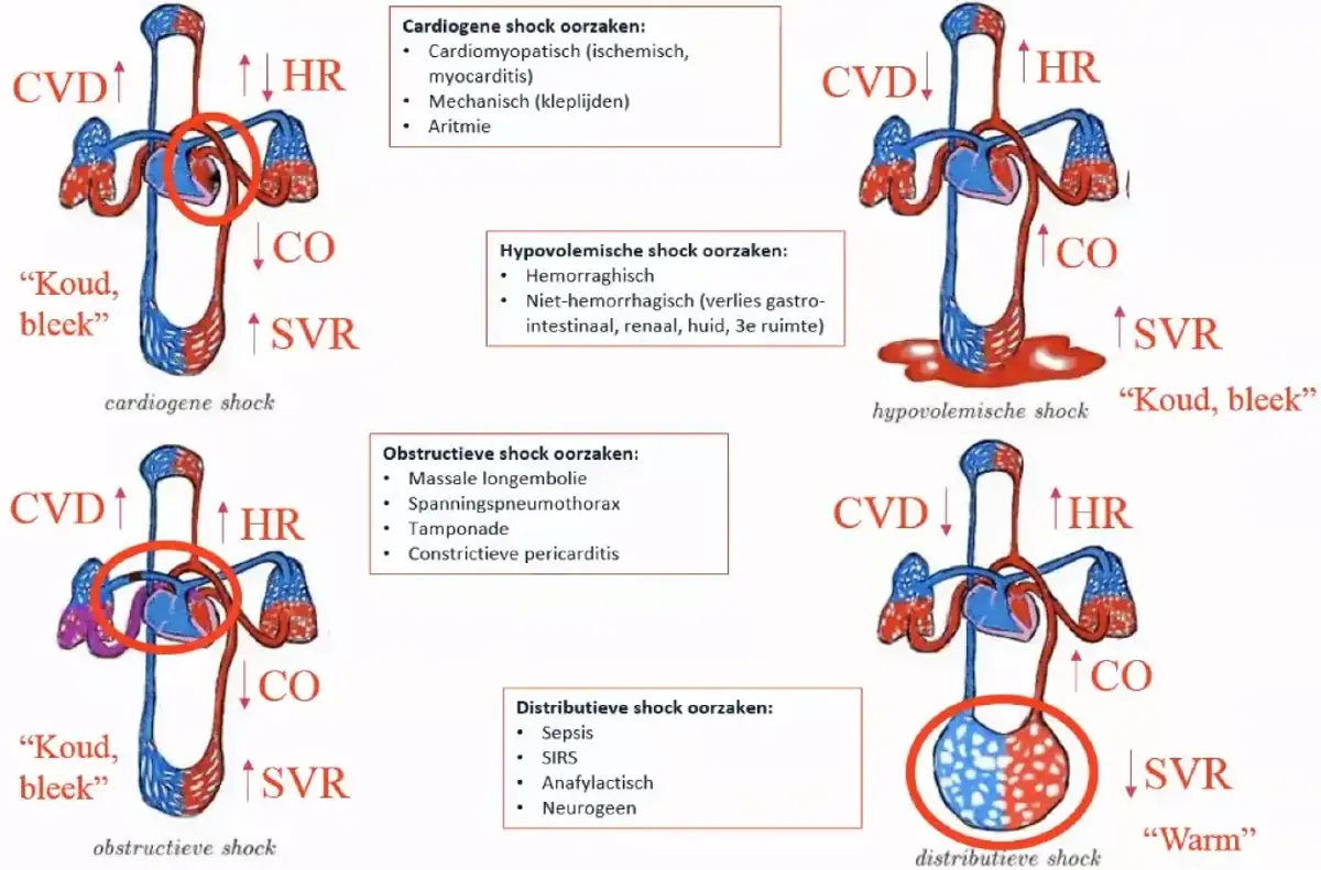 Abdominale Chirurgie: Viscerale en Parietale Pijnanalyse - Studeersnel