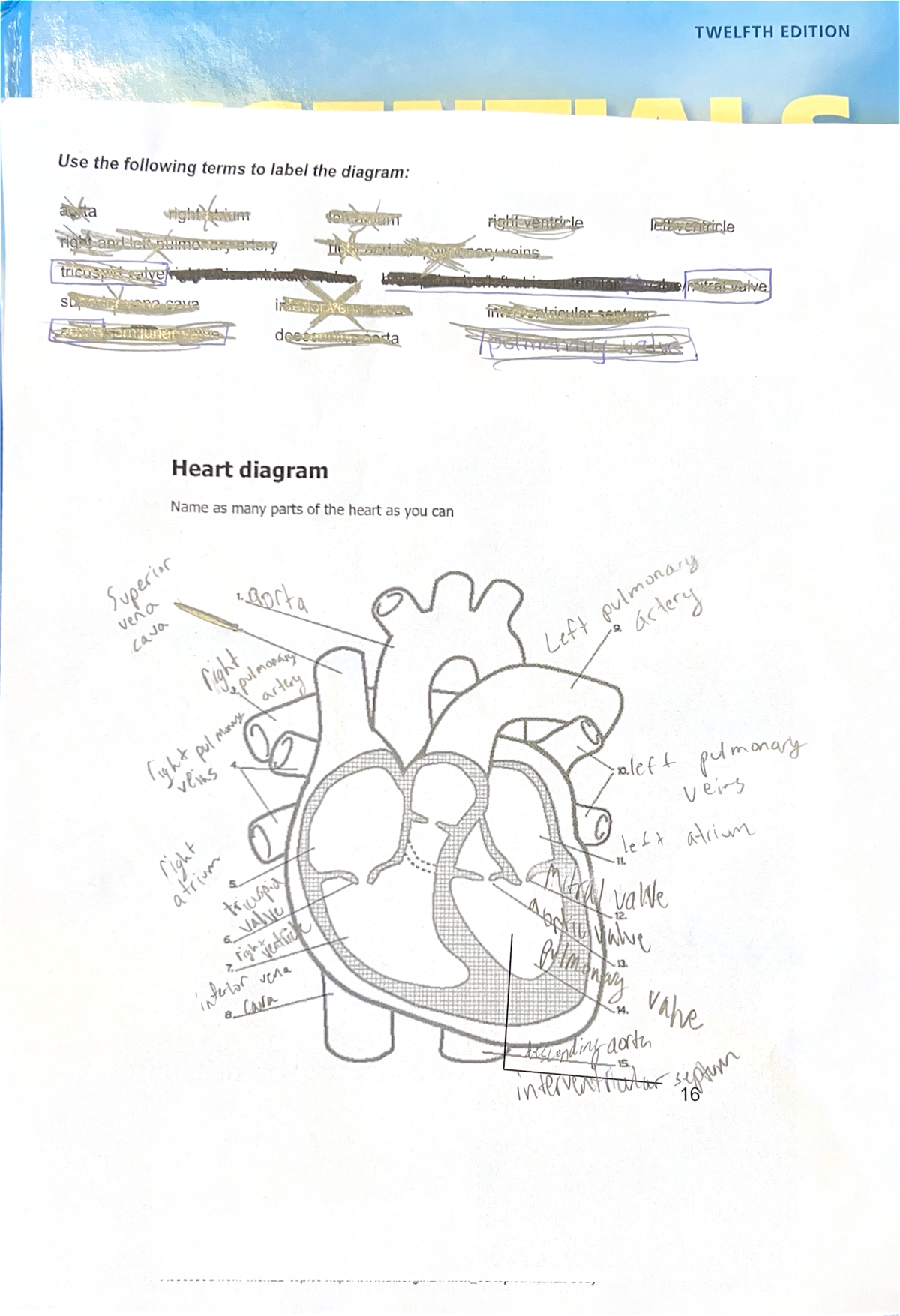 Heart Diagram Labeling Guide: Key Terms and Components - Studocu