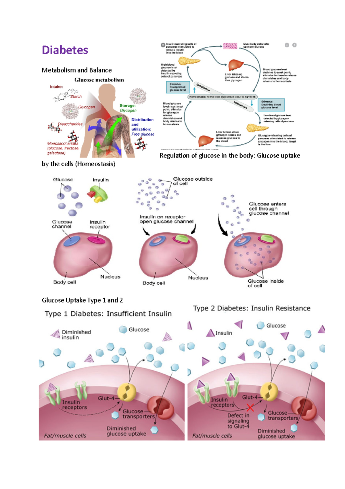Diabetes Exam Notes (PHYS 201): Understanding Type 1 & Type 2 ...