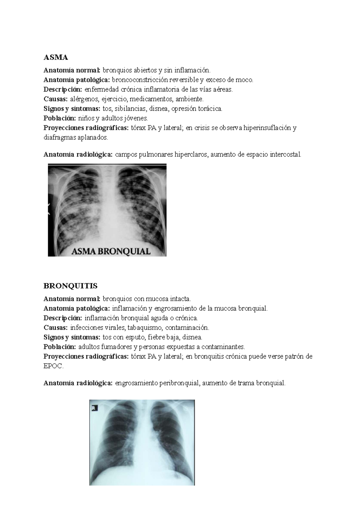 ASMA Anatomía Normal y Patológica: Bronquios y Enfermedades ...
