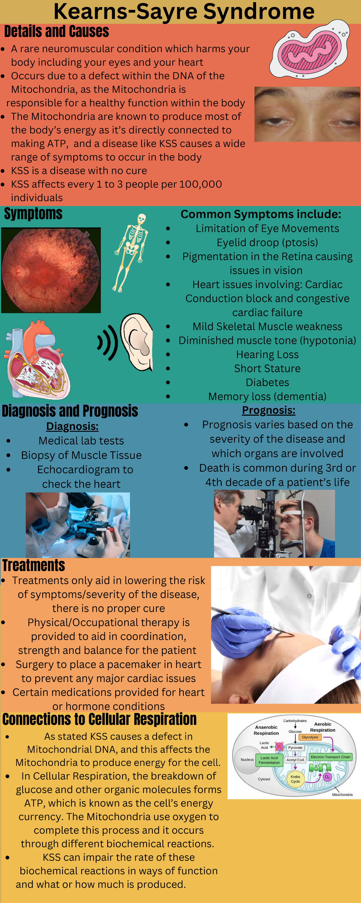 Kearns-Sayre Syndrome (KSS) Infographic: Causes & Effects in Biology ...
