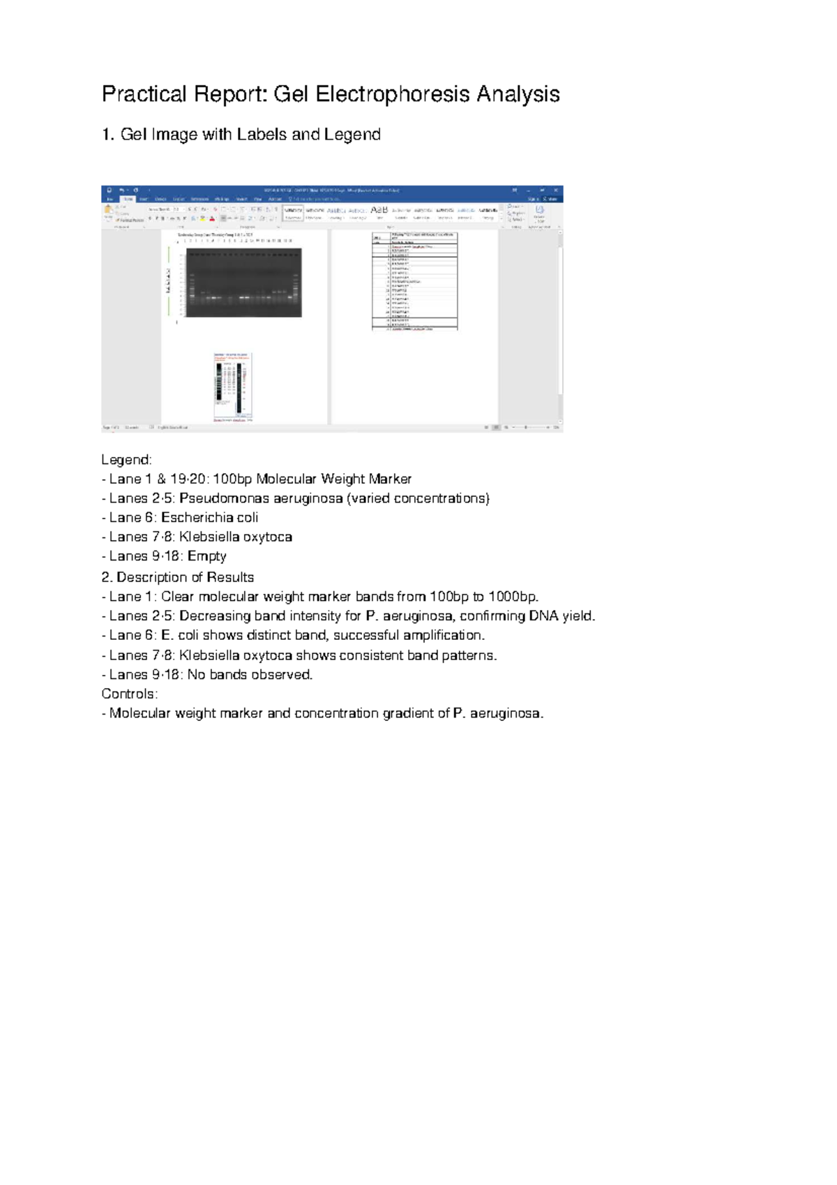 Practical Report: Gel Electrophoresis Analysis (BIO 101) - Studocu