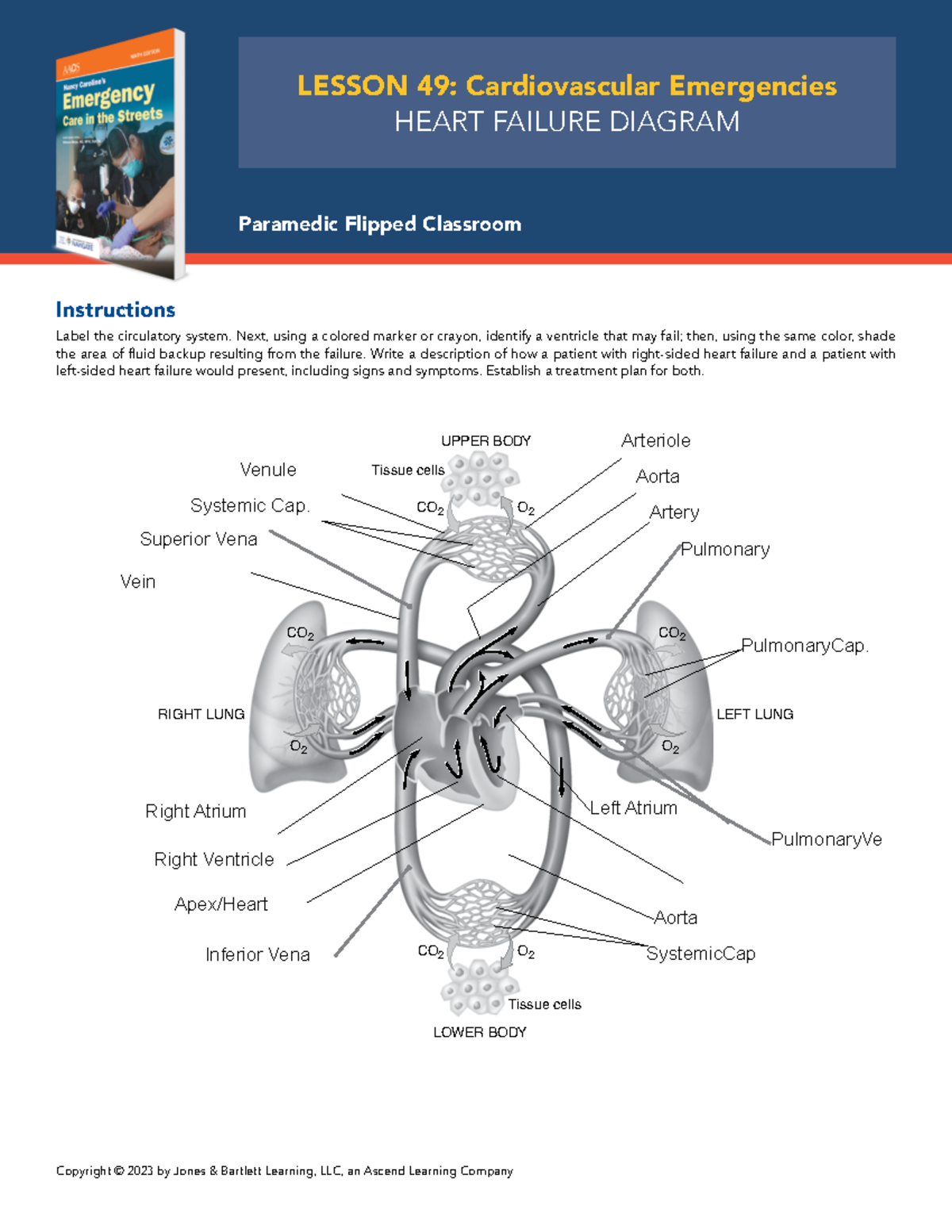 Lesson 49 Heart Failure Diagram - Paramedic Flipped Classroom LESSON 49 ...