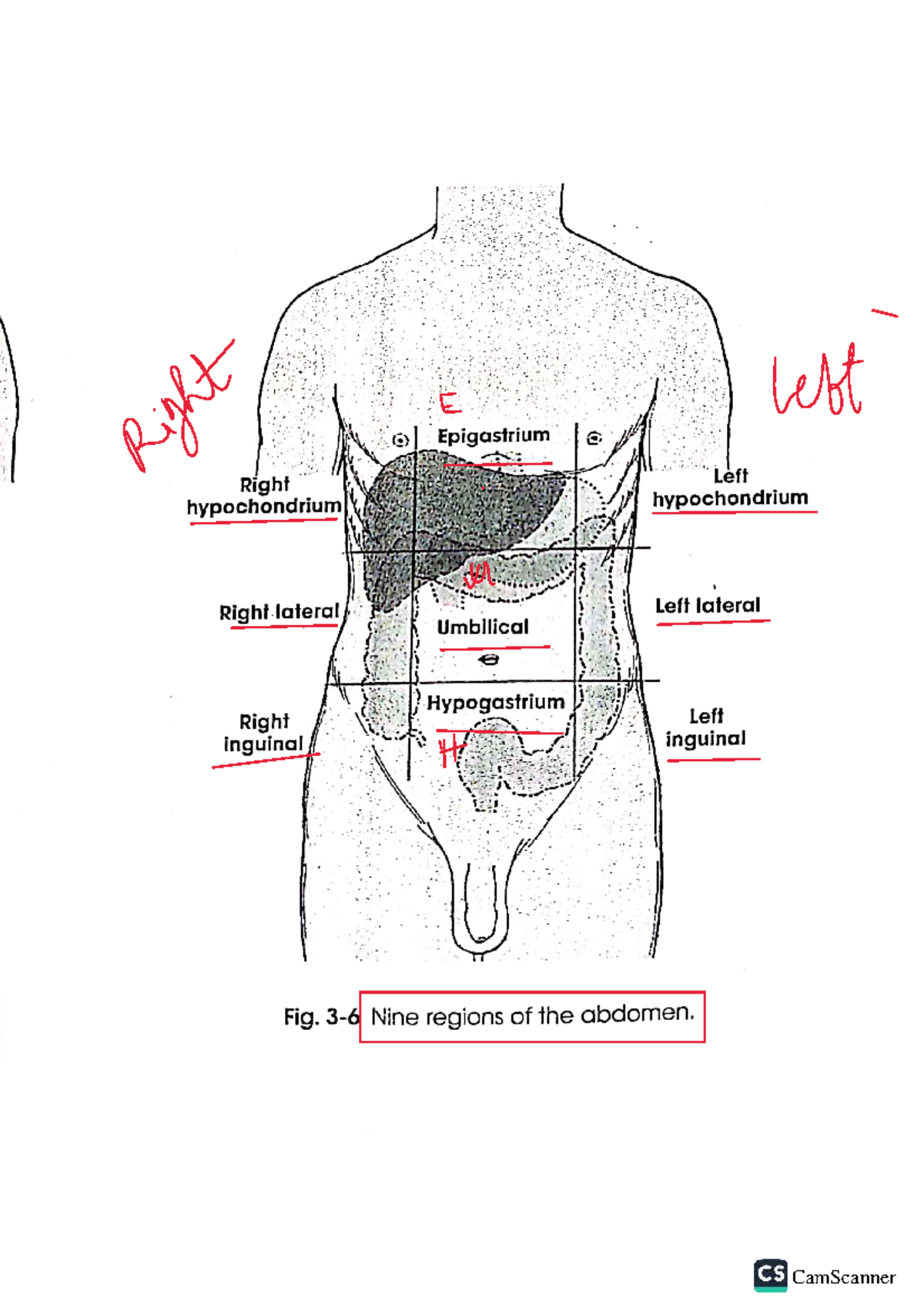 ABD 101: Anatomical Landmarks of the Abdomen and Surrounding Areas ...
