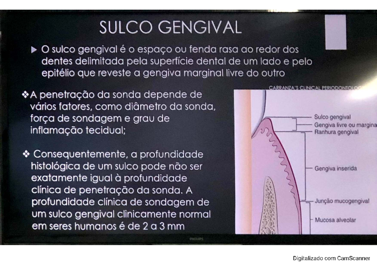 Título: Anatomia e Função do Sulco Gengival na Periodontologia Clínica ...