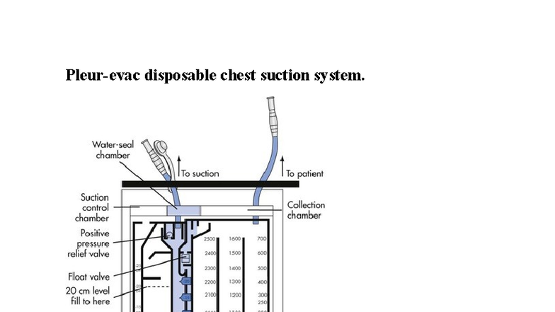 Pleur-Evac Disposable Chest Suction System Setup Guide - Studocu
