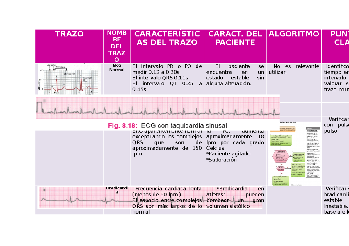 Características del Trazo EKG y Ritmos Cardiacos - Curso EKG 101 - Studocu