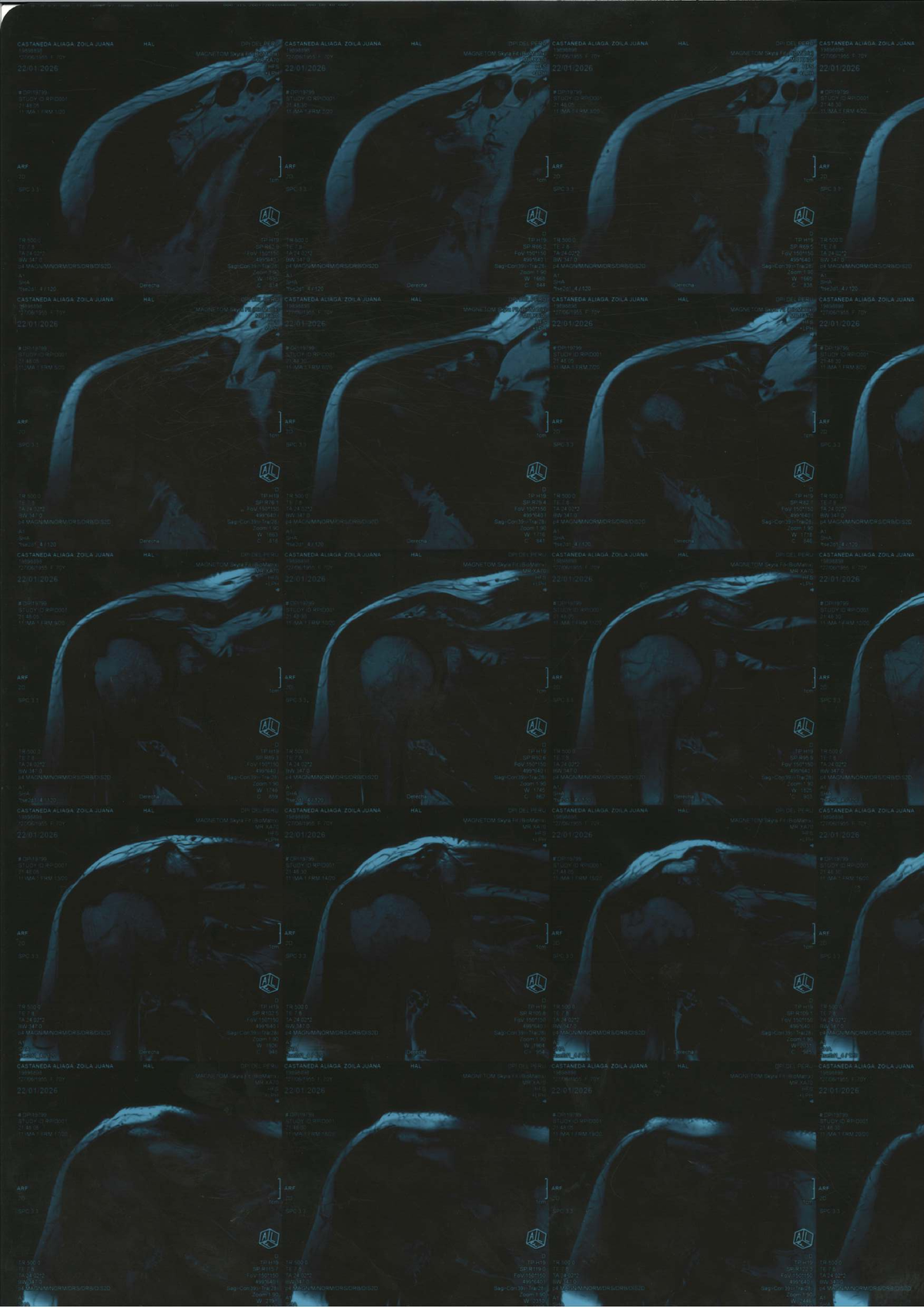Study on MAGNETOM Skyra Fit (BioMatrix) - RPID001 - Studocu