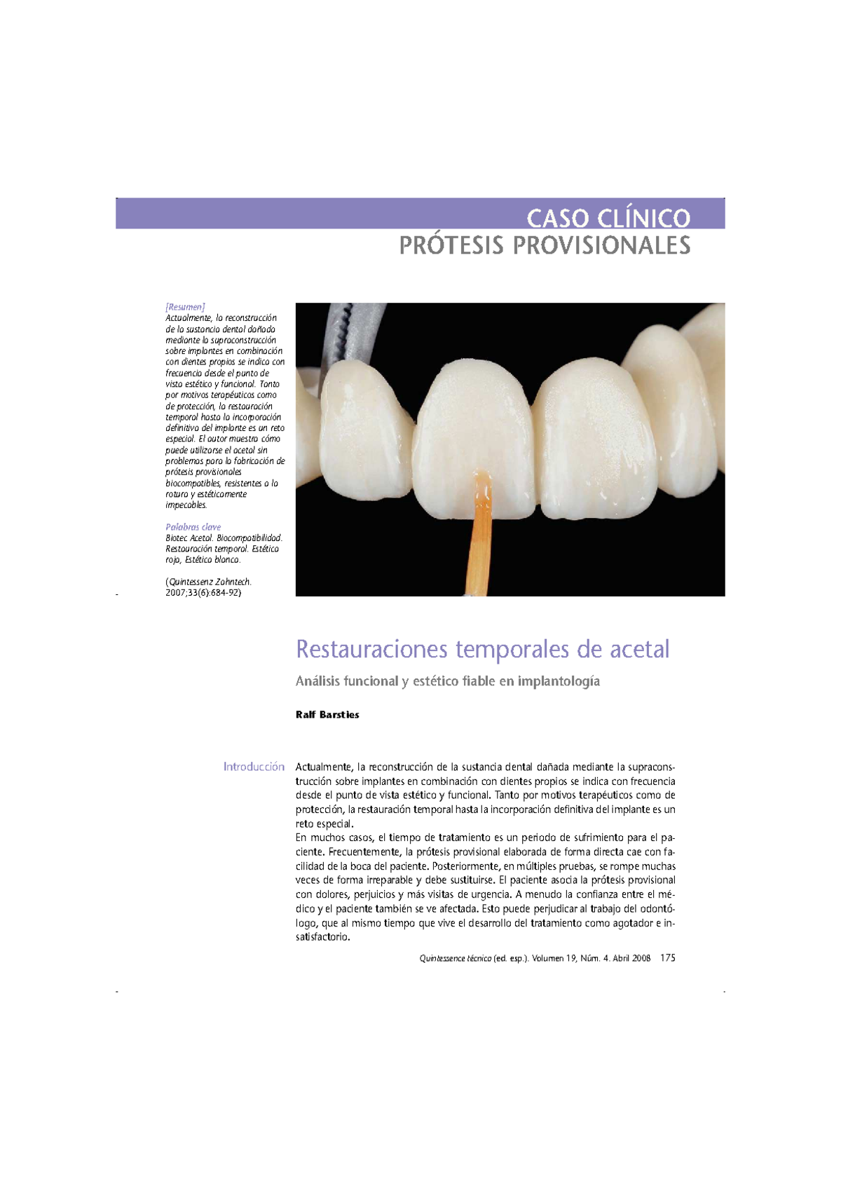 CASO CLÍNICO: PRÓTESIS PROVISIONALES CON ACETAL EN IMPLANTOLOGÍA - Studocu