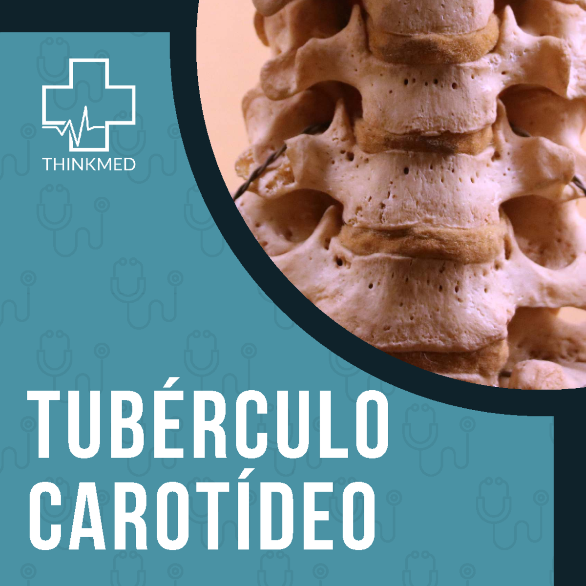 Tuberculo carotideo - Tubérculo carotídeo - Anatomía y Fisiologia ...