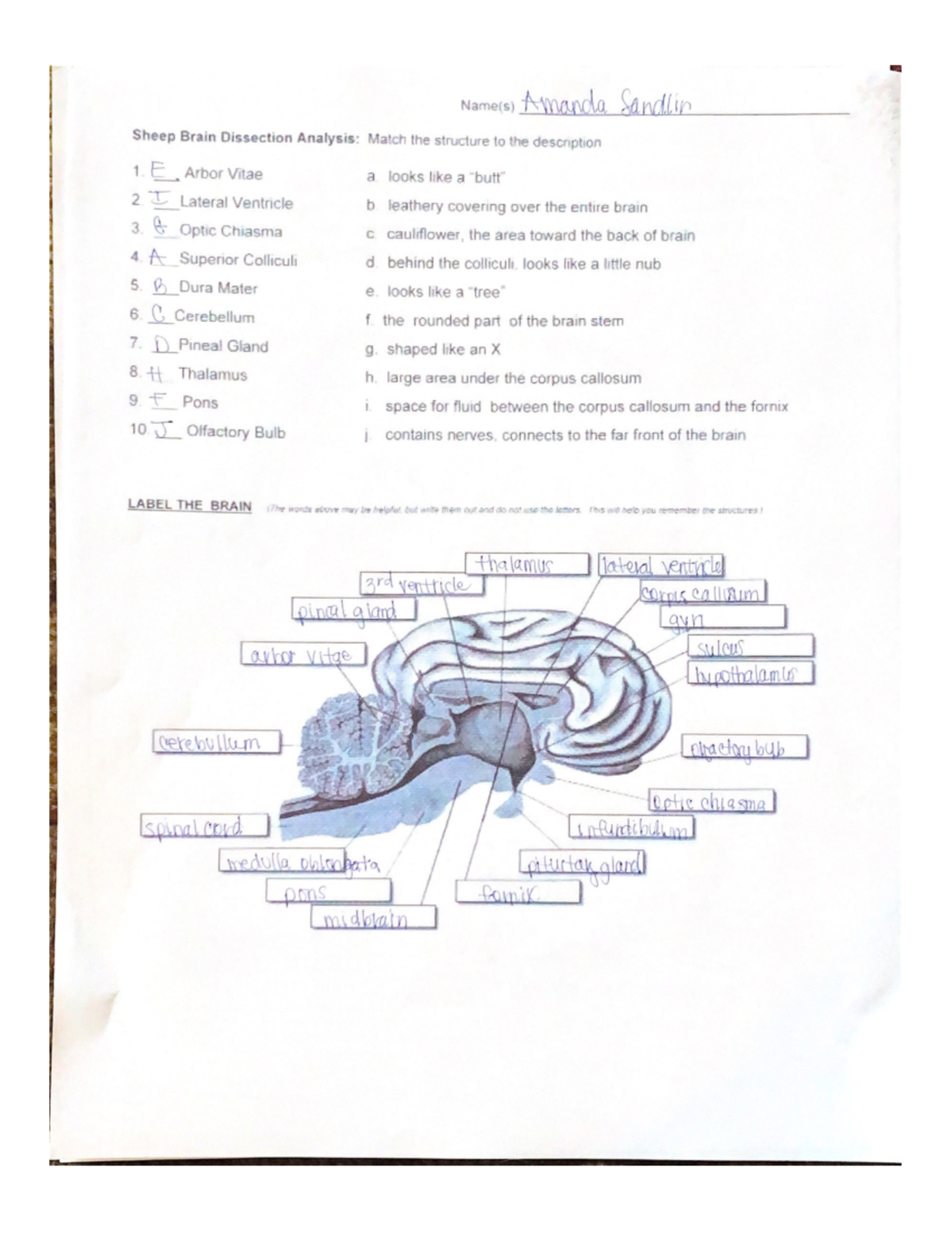 Sheep Brain Dissection Analysis Match - Arbor Vitae LD _Lateral ...