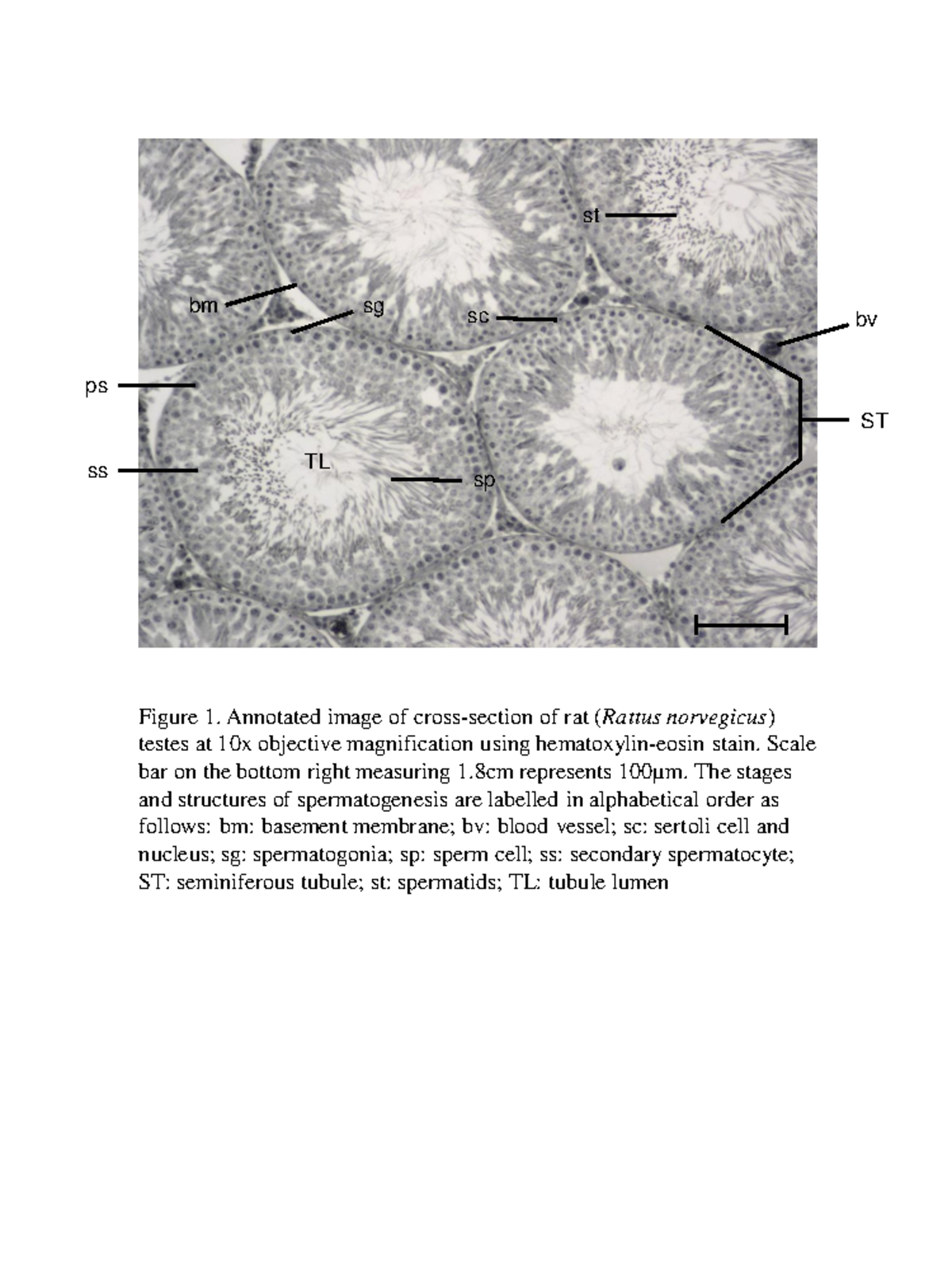 BIO1140 Meiosis Lab: Annotated Rat Testes Cross-Section Analysis - Studocu