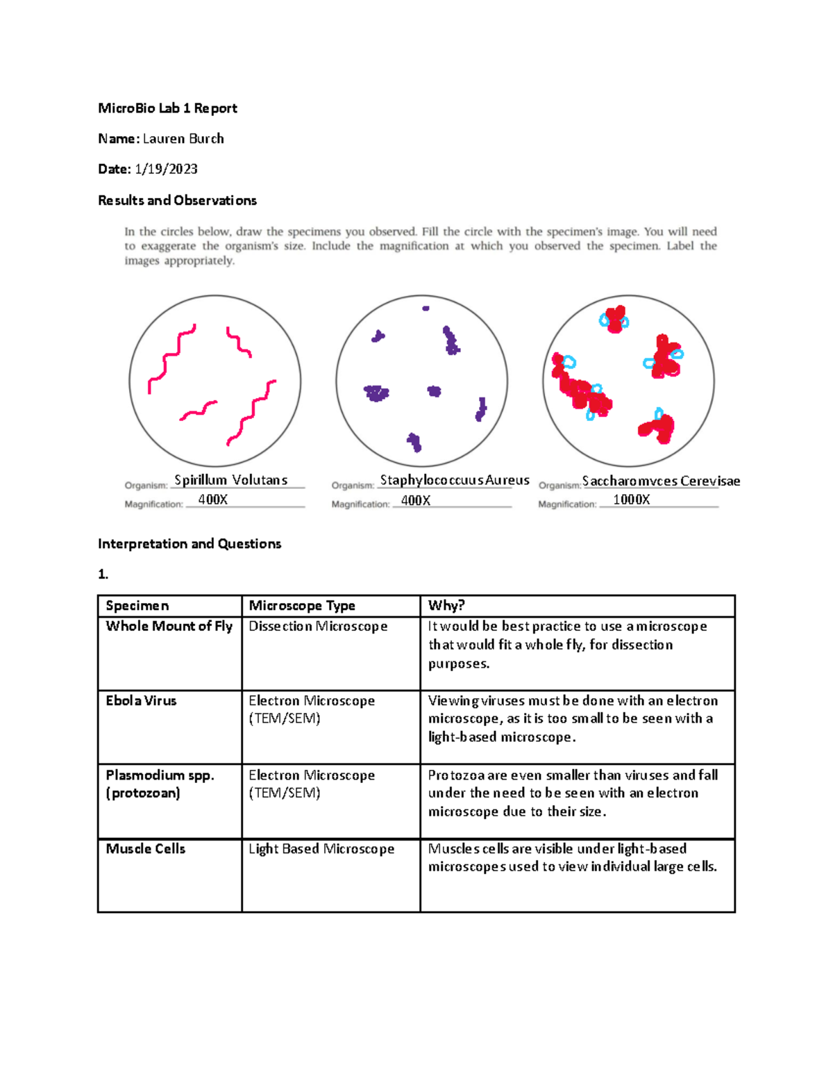 Lab Report 1 Use of the Microscope - MicroBio Lab 1 Report Name: Lauren ...