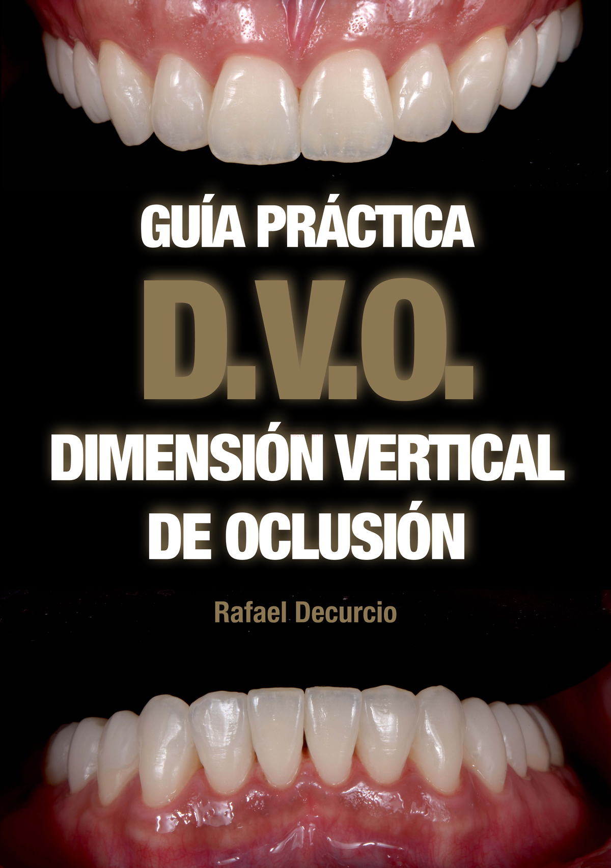 GUÍA PRÁCTICA D.V.O. PARA AUMENTO DE DIMENSIÓN VERTICAL OCLUSIÓN - Studocu