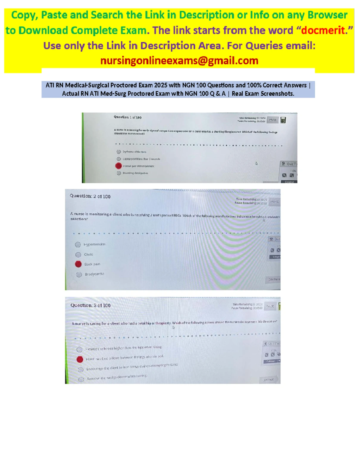 ATI RN Medical Surgical Proctored Exam 2025: Key Questions & Answers ...