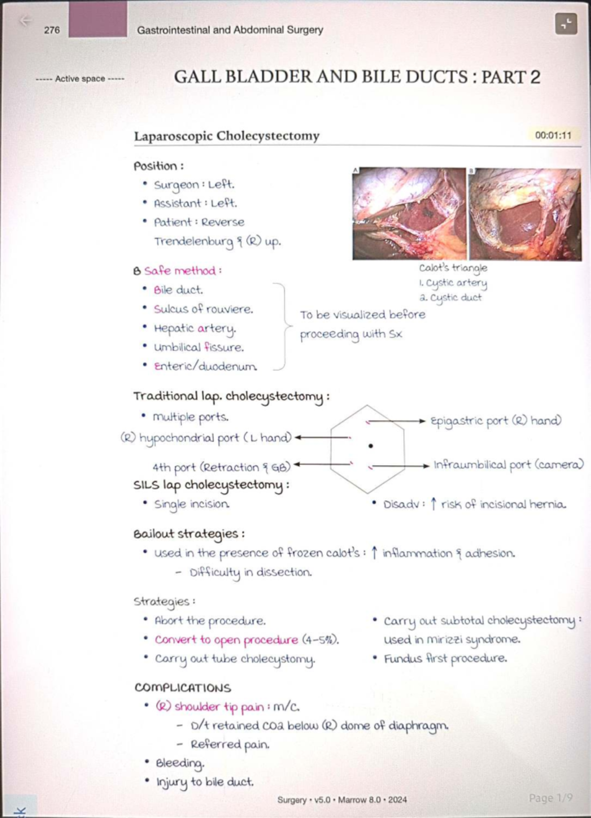 Gall Bladder and Bile Ducts: Part 2 - Laparoscopic Cholecystectomy ...