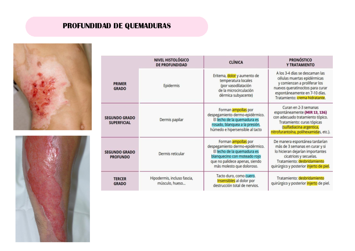 Clasificación de las Quemaduras: Profundidad y Tratamiento Clínico ...