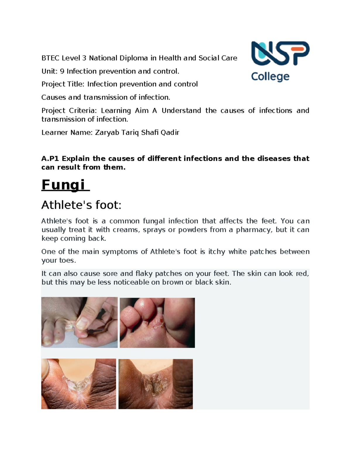 Unit 9 H&SC: Infection Prevention and Control Overview and Key Insights ...