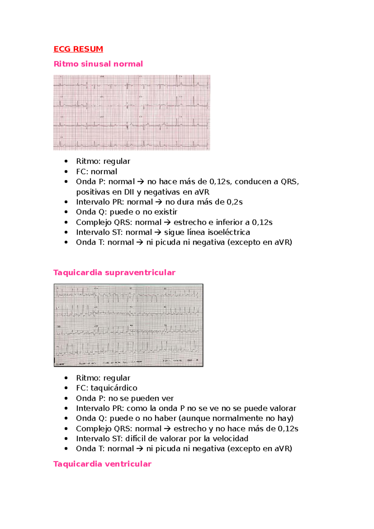 ECG RESUM: Análisis de Ritmos y Arritmias - Electrods - Studocu