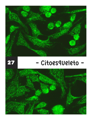Características Morfológicas del Cúbito y Radio - Guía de Estudio - Studocu