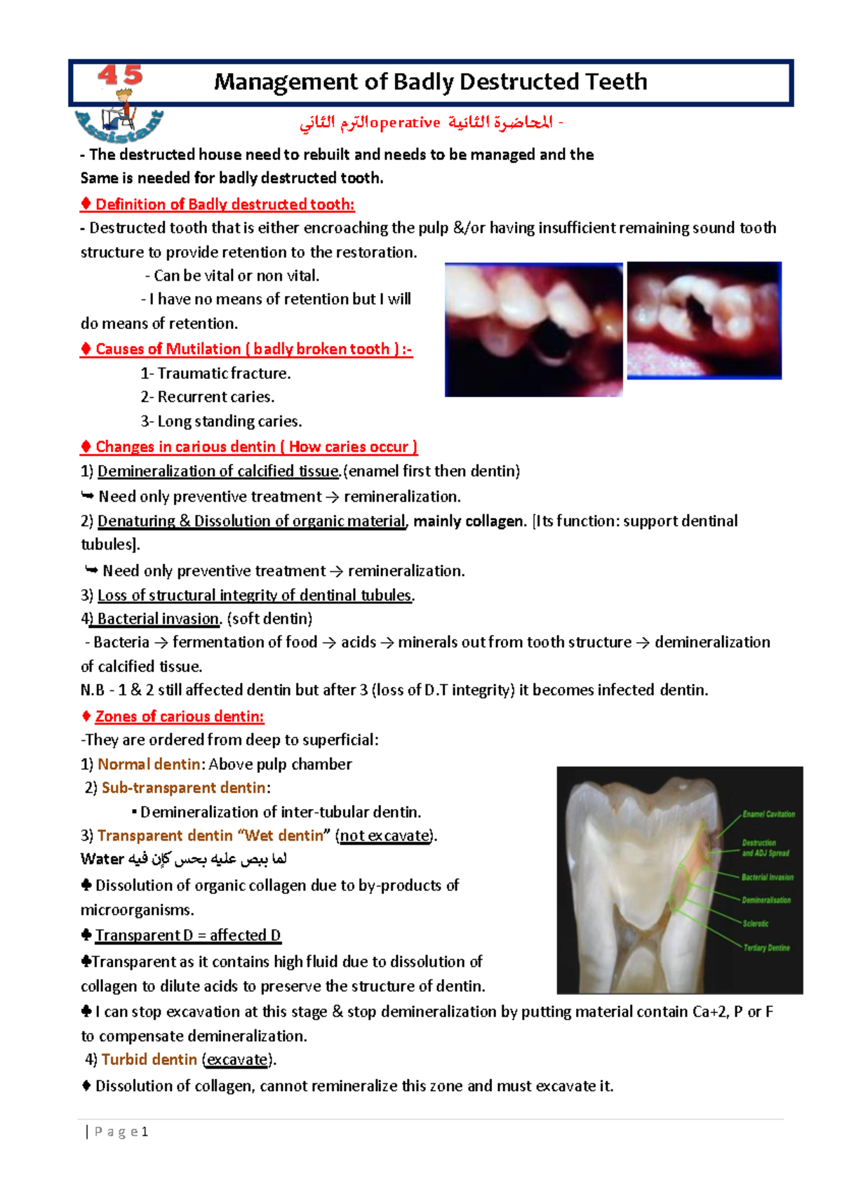 02 - Management of Badly Destructed Teeth: Techniques & Considerations ...