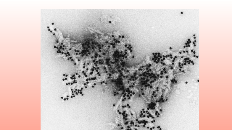 Title: Ch04 Protein Stability Dynamics: Amyloid Fibrils & Prion ...
