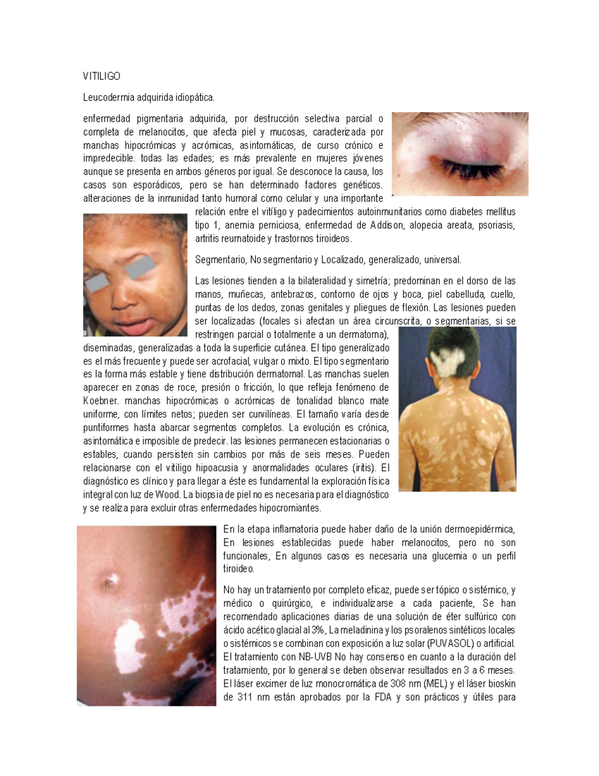 Vitiligo Y Melasma - tareas de dermatologia - VITILIGO Leucodermia ...