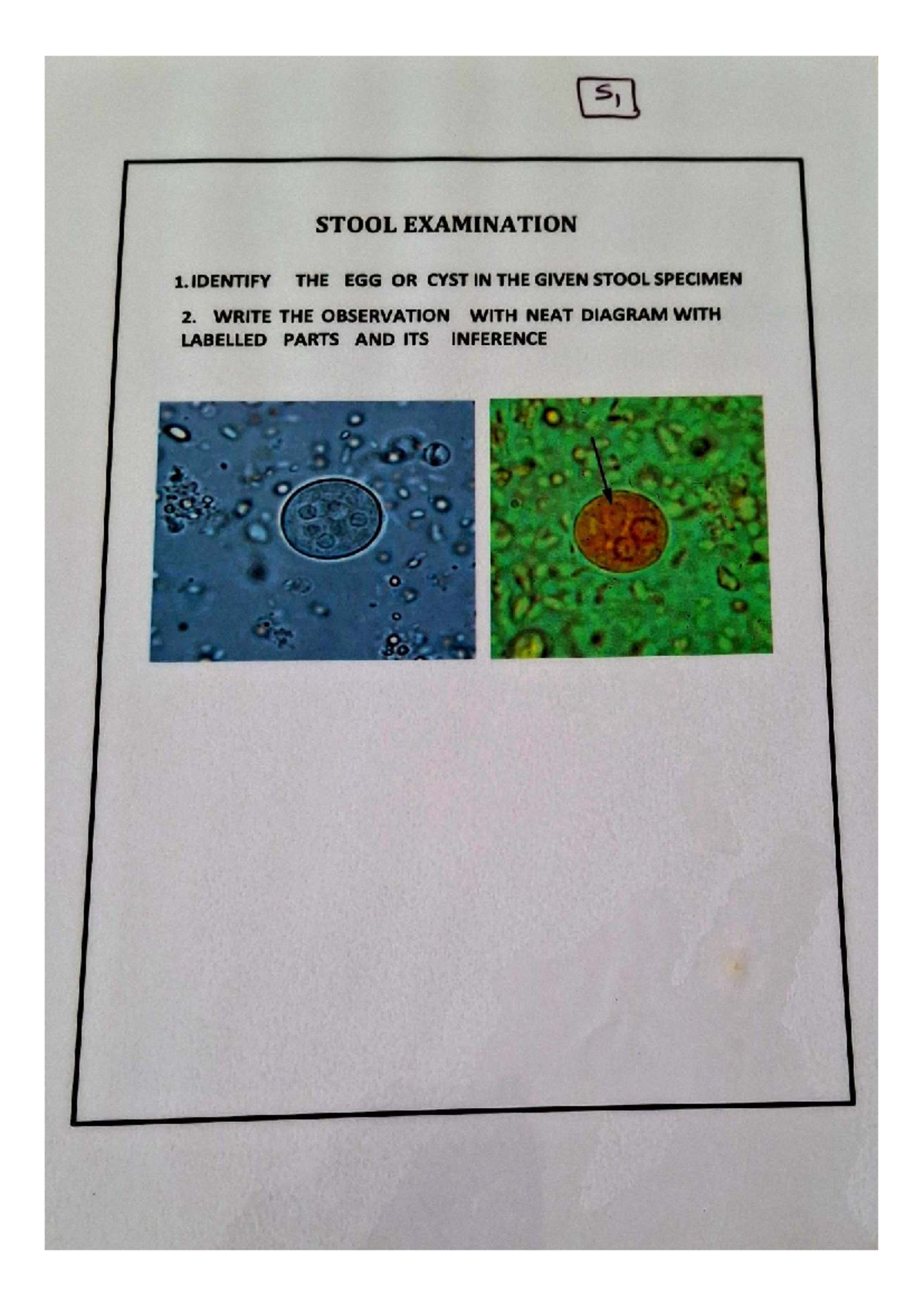 S2 Microbiology: Stool Examination & Clinical Case Studies - Studocu