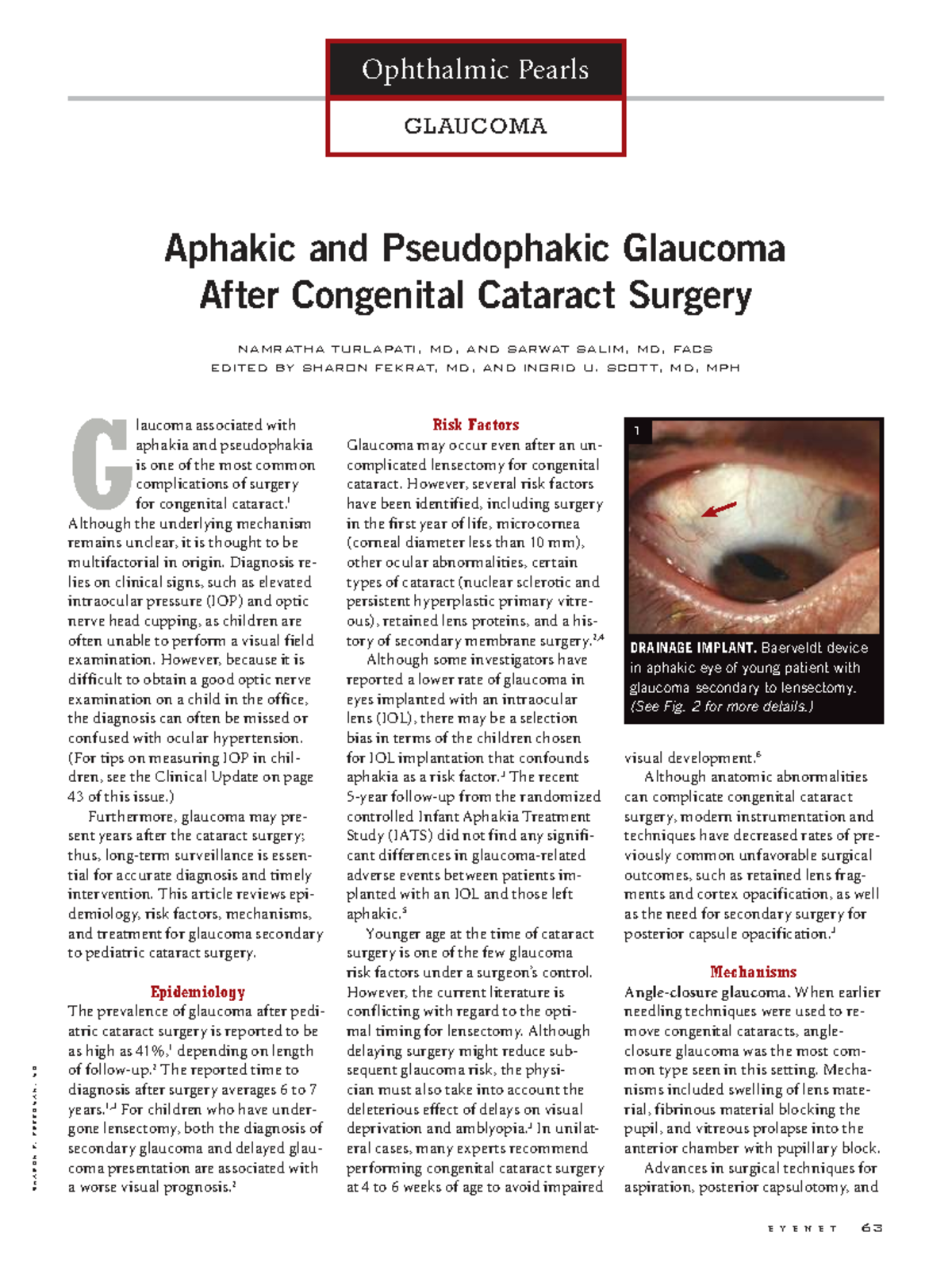 Ophthalmic Pearls: GLAUCOMA in Aphakic & Pseudophakic Cases Post ...