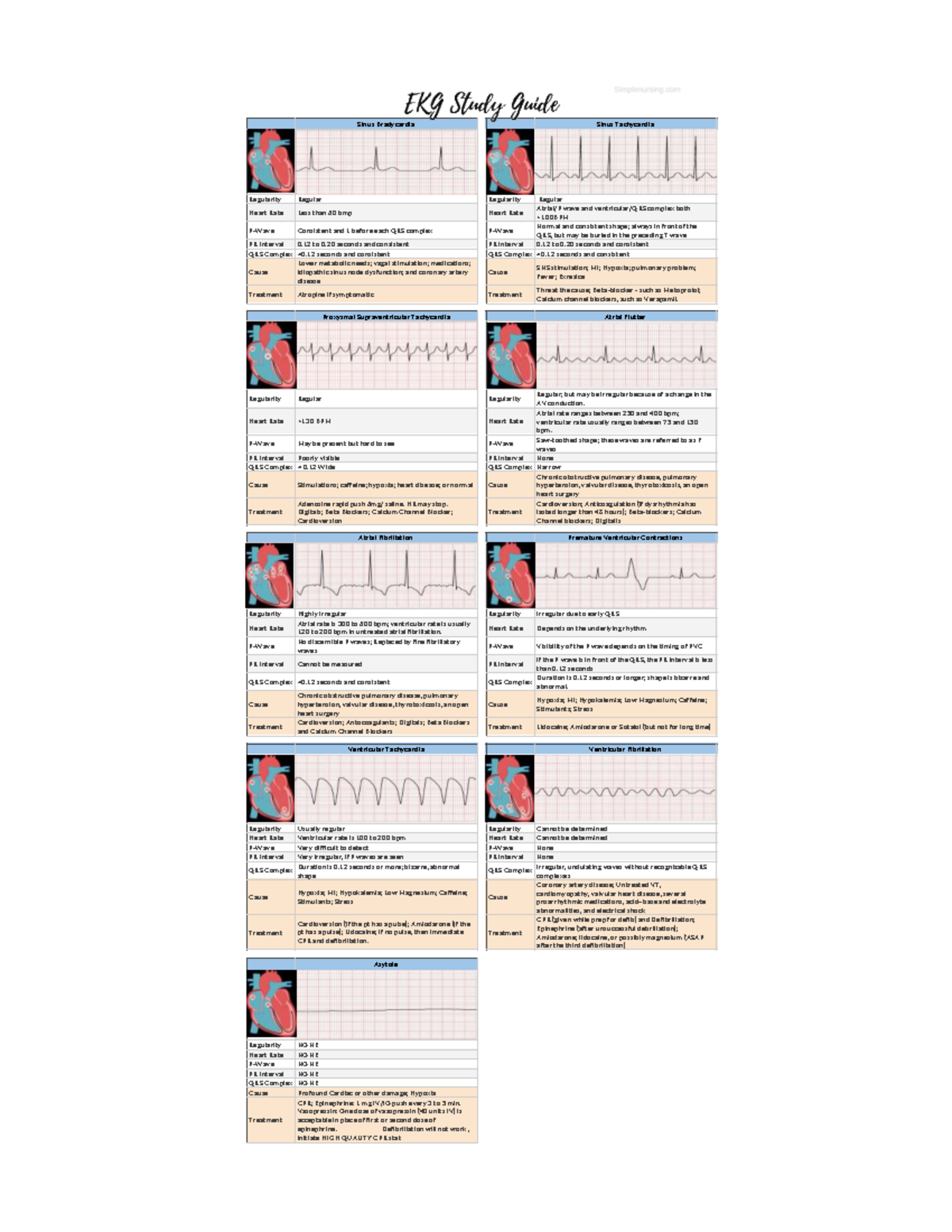 EKG Dysrhythmias - Study material - Sinus Bradycardia Sinus Tachycardia ...