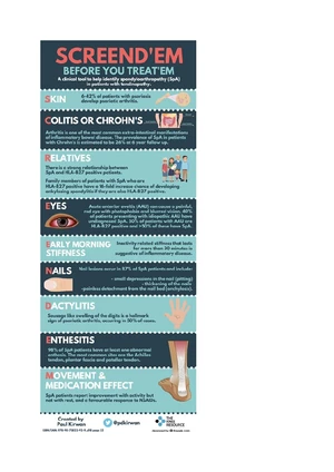 Ankylosing Spondylitis Screening Infographic Guide - Studocu