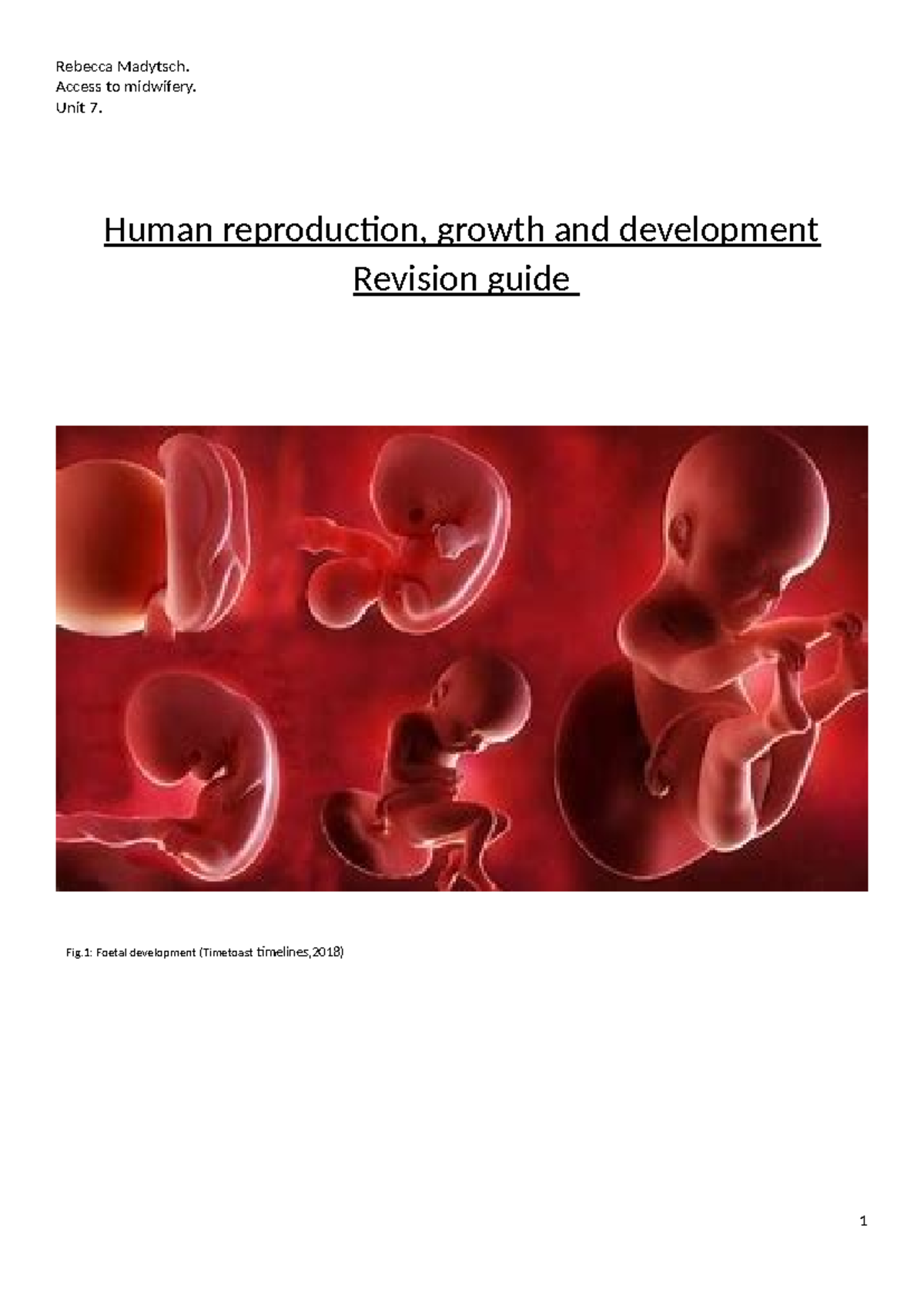 Human reproduction - Access to midwifery. Unit 7. Human reproduction ...