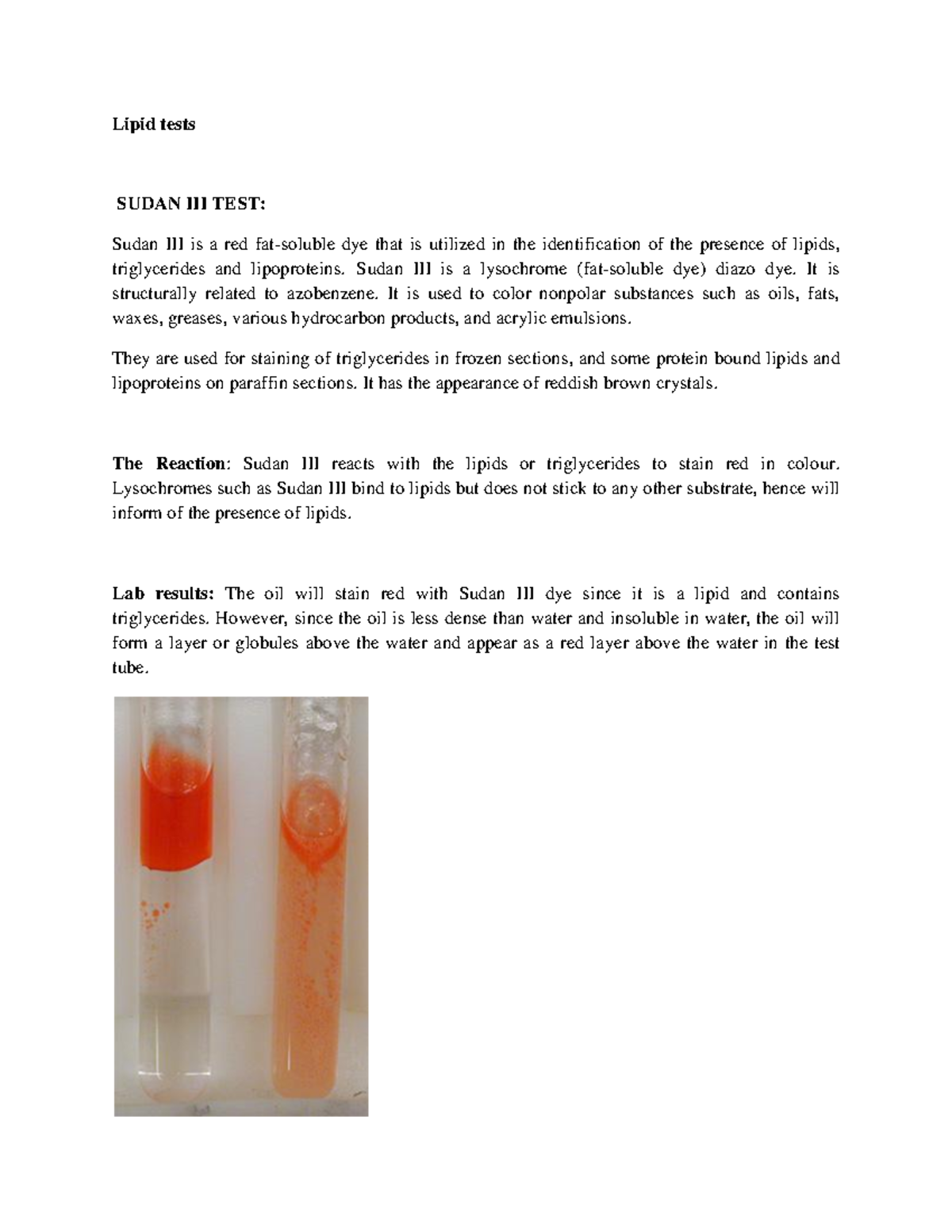 1849 BIO 1 - Sudan III Test for Lipid Identification and Analysis - Studocu