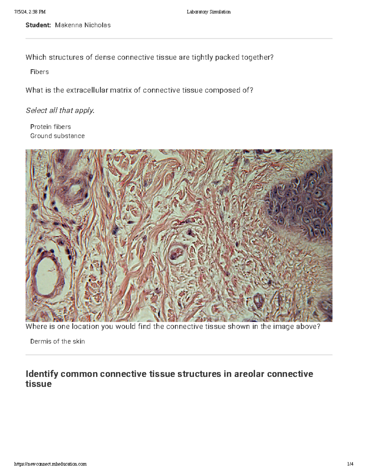 Mod 2 - Connective Tissue Lab - Student: Makenna Nicholas Which ...