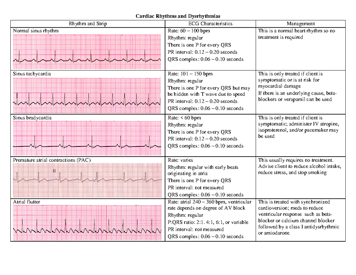 Cardiac-dysrhythmias compress - Cardiac Rhythms and Dysrhythmias Rhythm ...