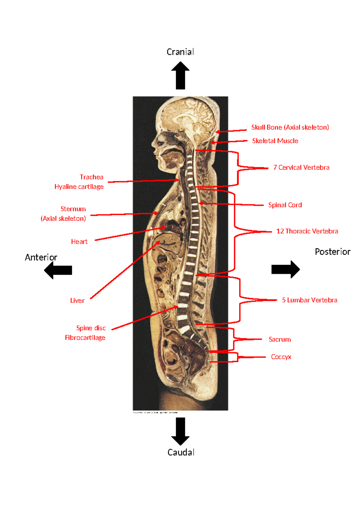 Block 1 Q4 - Anatomy Labelled Diagram - DEV2022 - Skull Bone (Axial ...