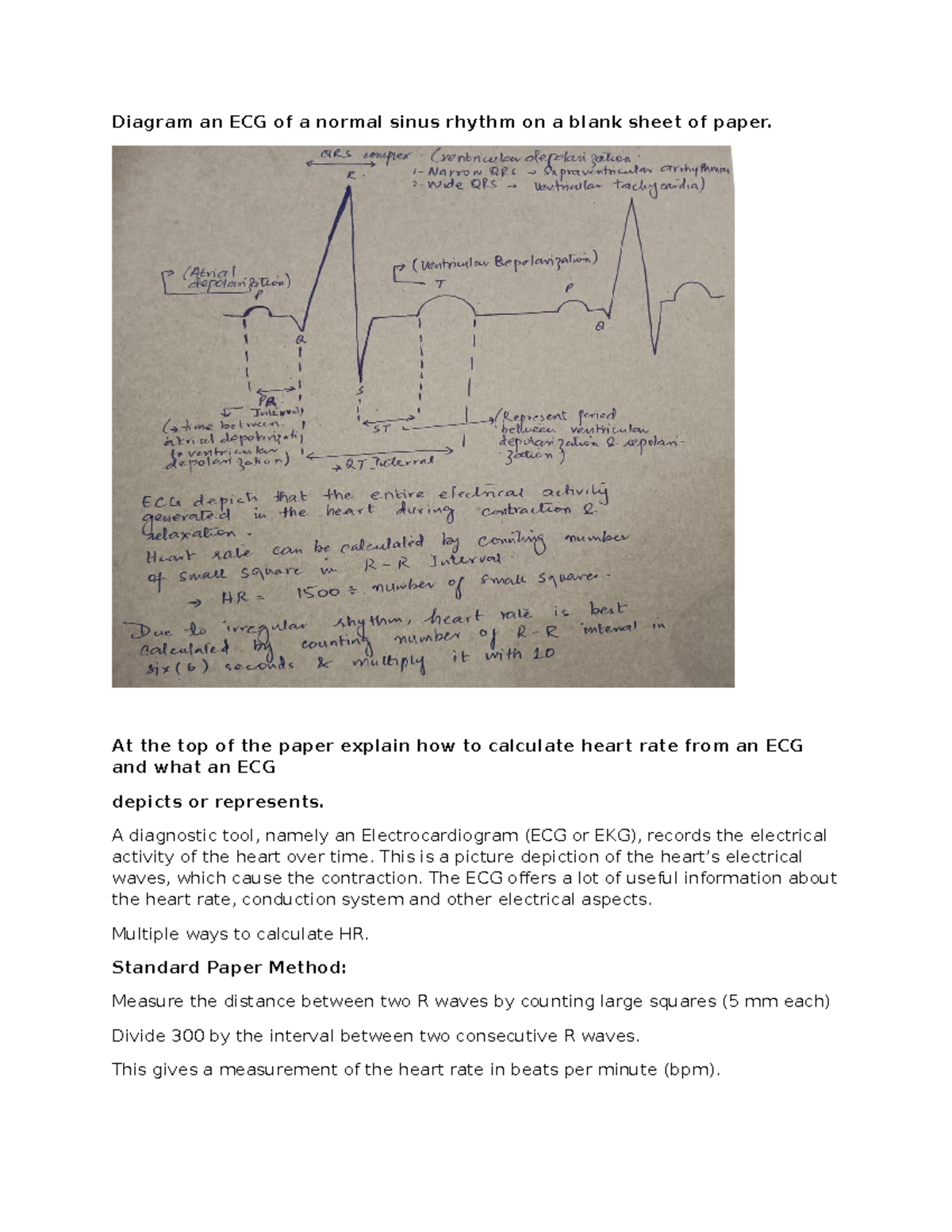 Cardiac Conduction & EKG: Understanding Heart Rate Calculation Methods ...