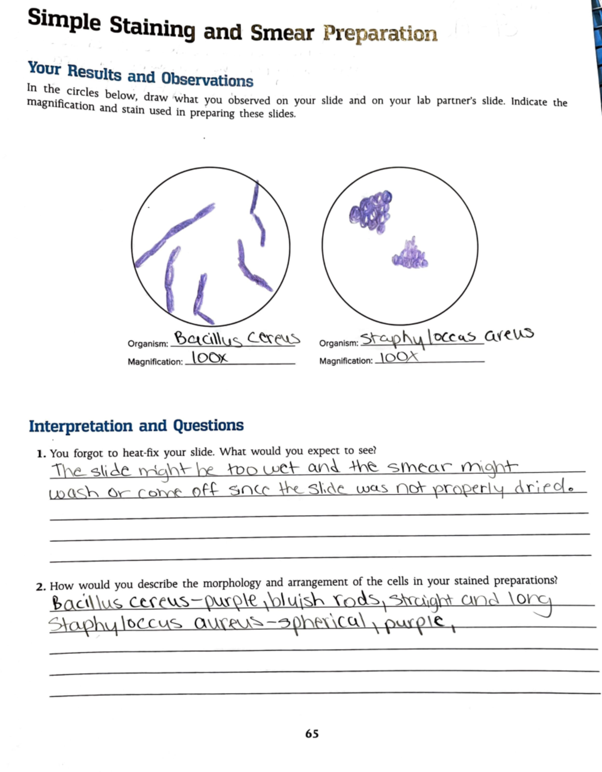 Staining Lab - laboratory results - Simple Staining and Smear ...