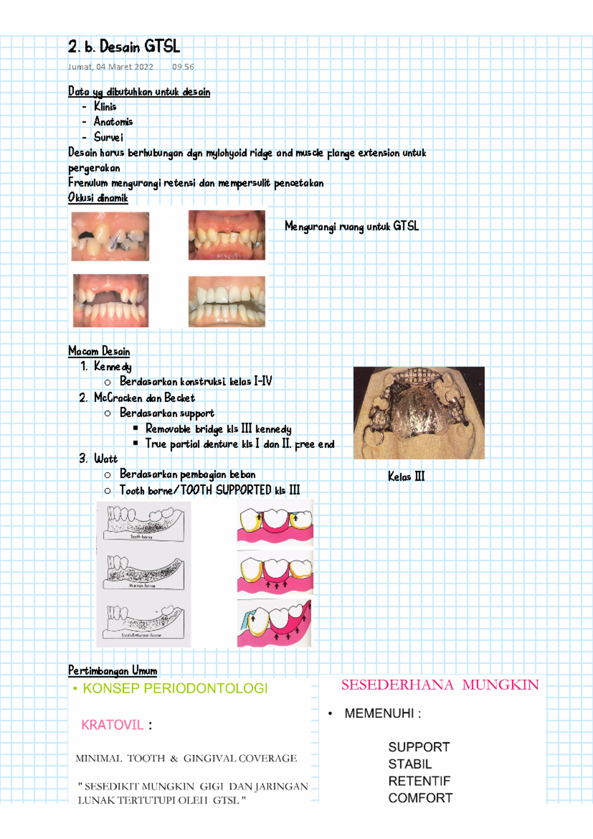 Prostodonsia II - 2.b. Desain GTSL dan Pertimbangan Klinis - Studocu