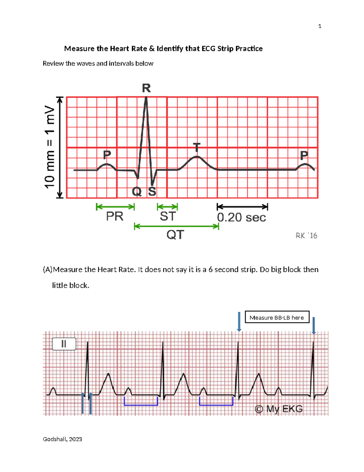 ECG Strip Practice: Measure Heart Rate & Rhythm Analysis (NUR 101 ...