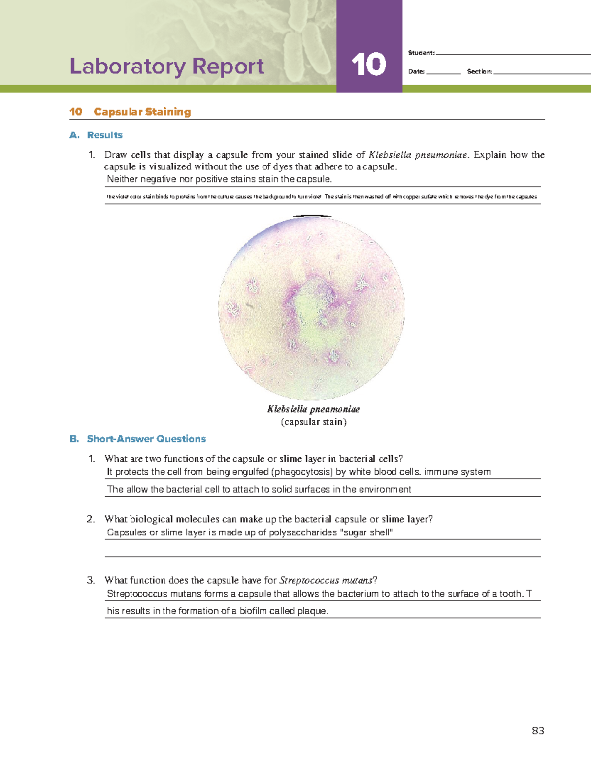 Exercise 10 Lab Report: Capsular Staining of Klebsiella pneumoniae ...