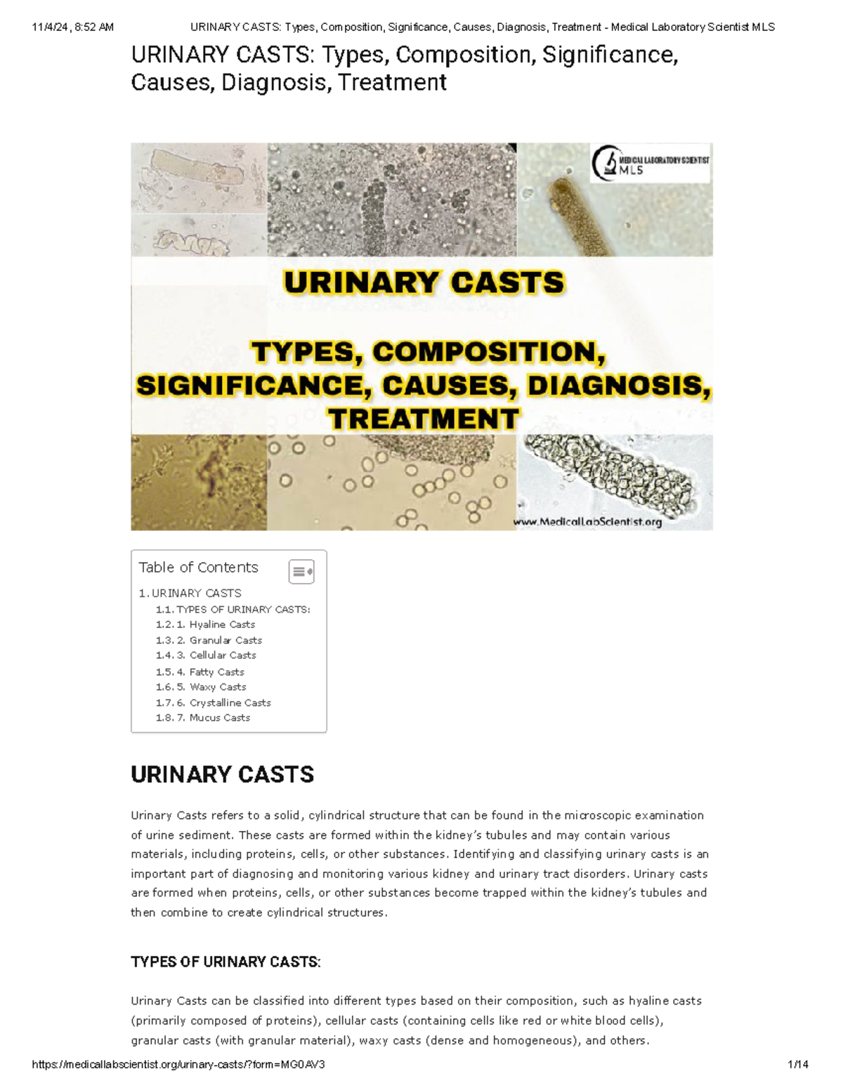 Urinary Casts: Types, Composition, and Diagnostic Significance - Studocu