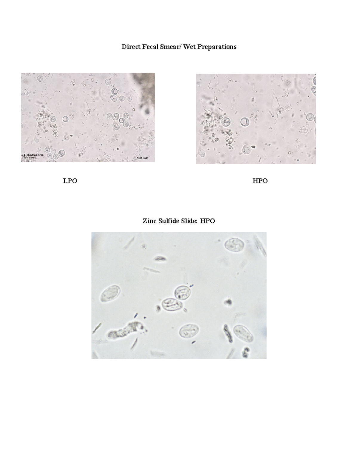 Direct Fecal Smear Preparation: LPO HPO Zinc Sulfide Slide - Studocu
