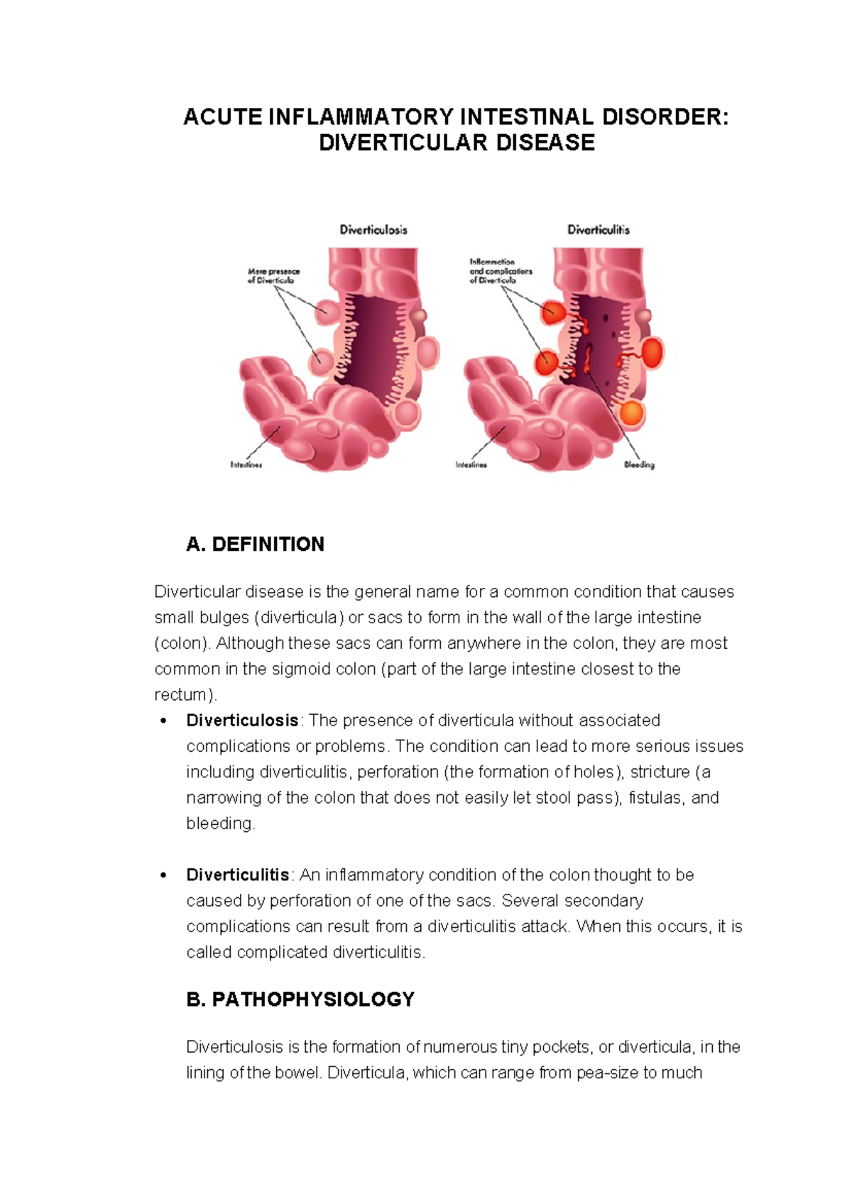 ACUTE INFLAMMATORY INTESTINAL DISORDER: DIVERTICULAR DISEASE OVERVIEW ...