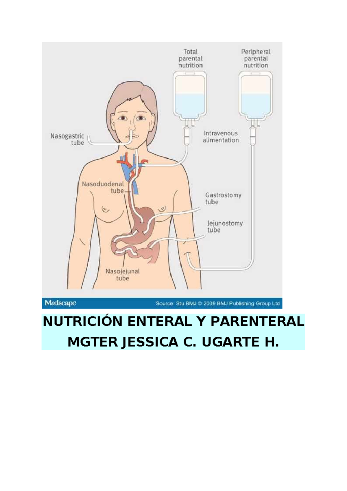 NUTRICIÓN ENTERAL Y PARENTERAL: Definiciones y Comparaciones - Studocu